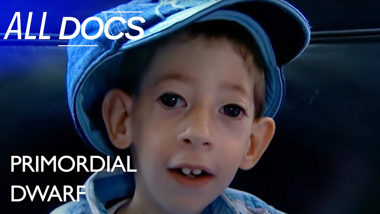 Human Dwarf Toddlers