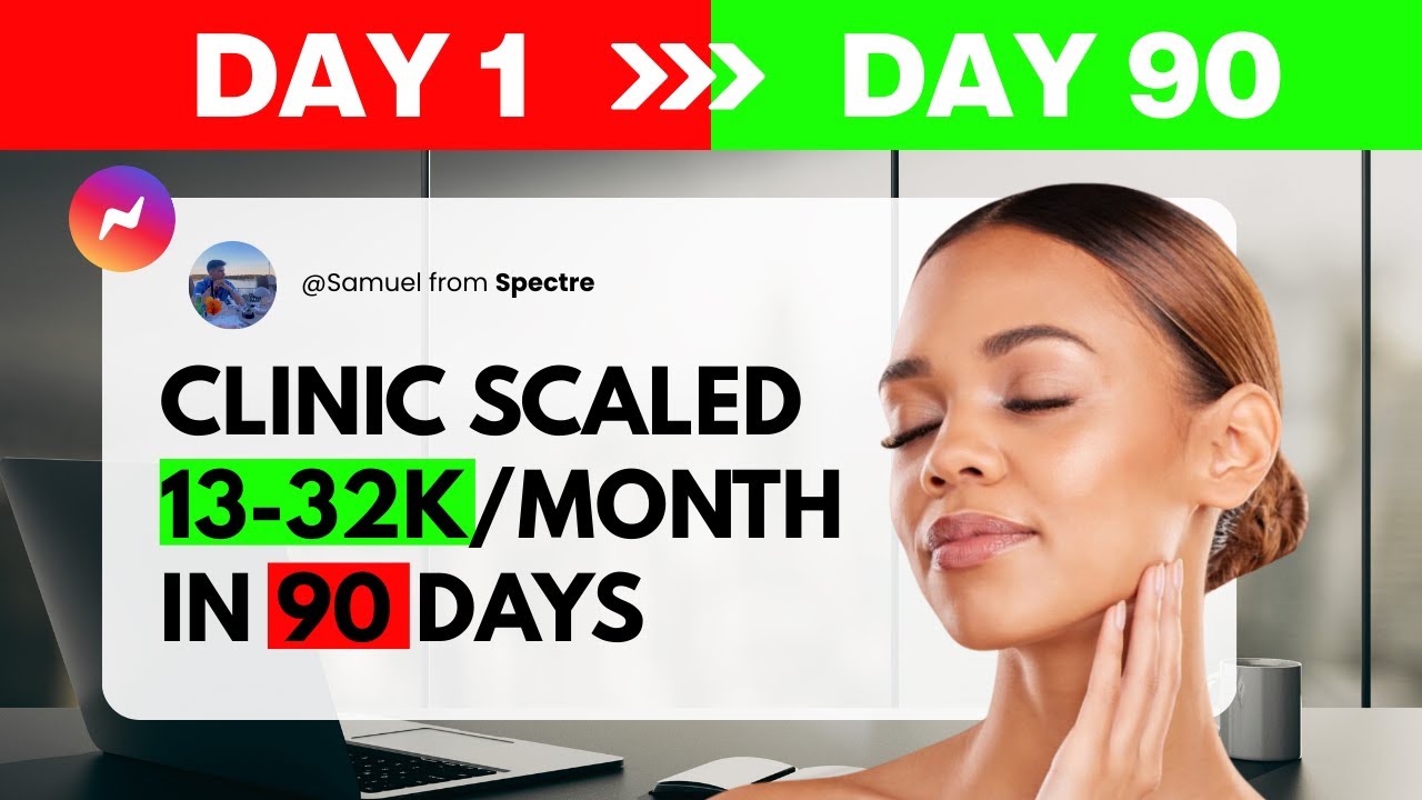 Full Instagram DM Ads System | Scale Your Clinic in 2025 - YouTube