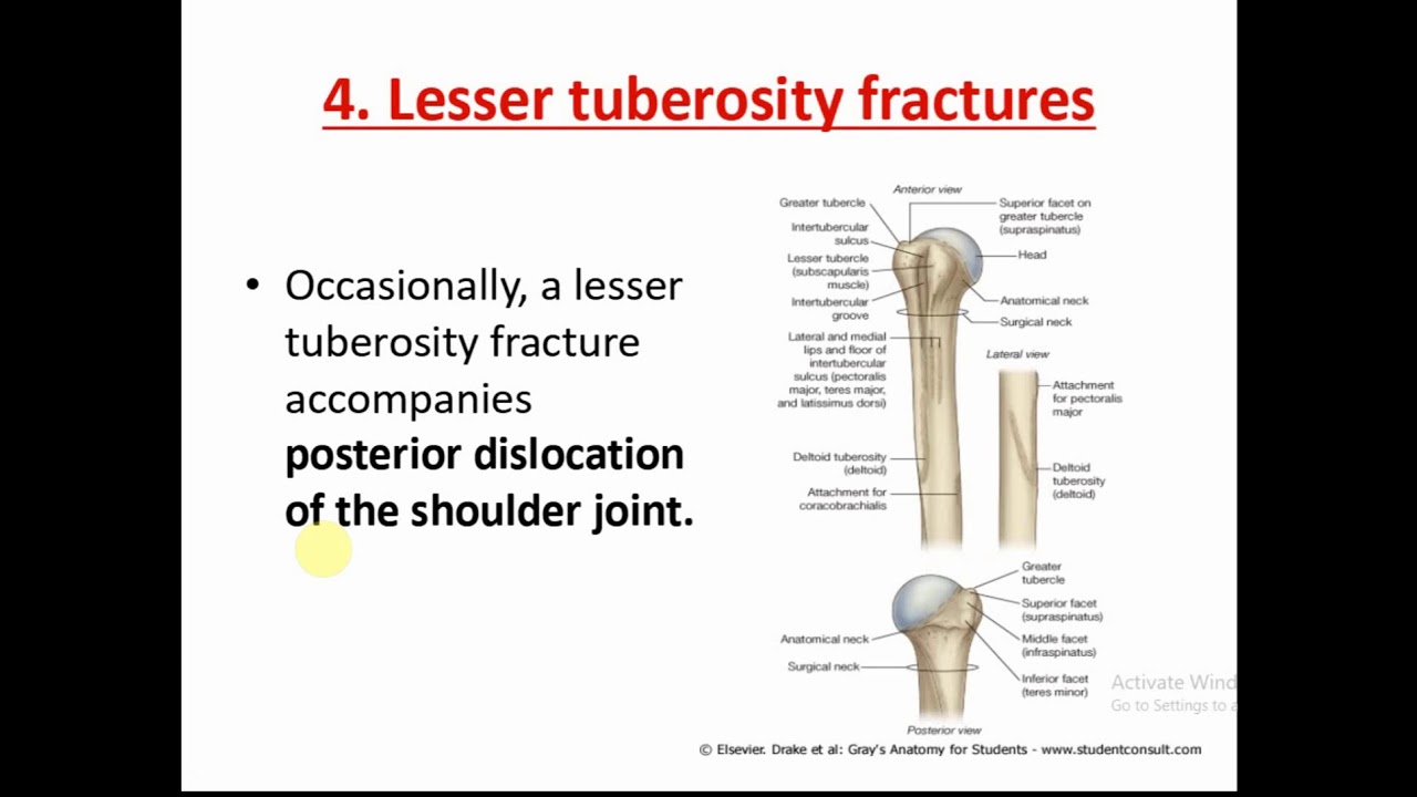 Lesser Tuberosity