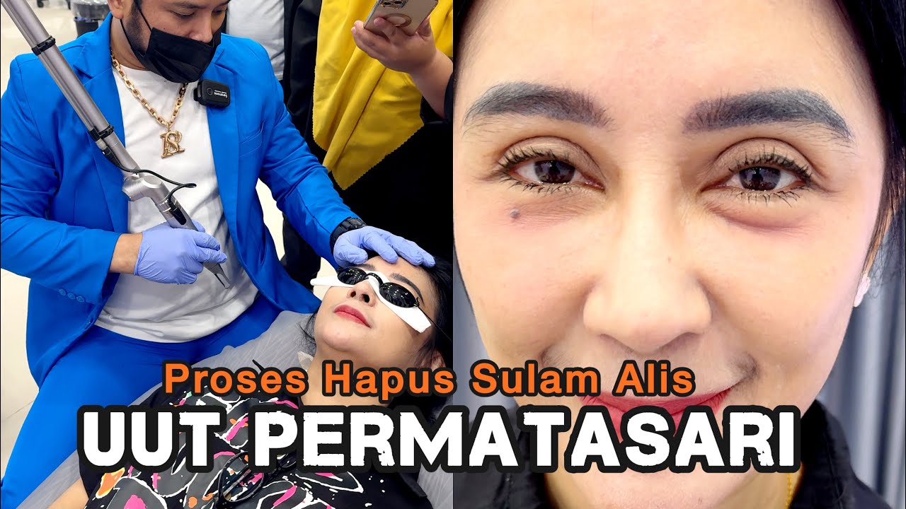 Uut Permatasari Pertama Kali Hapus Sulam Alis | By ...