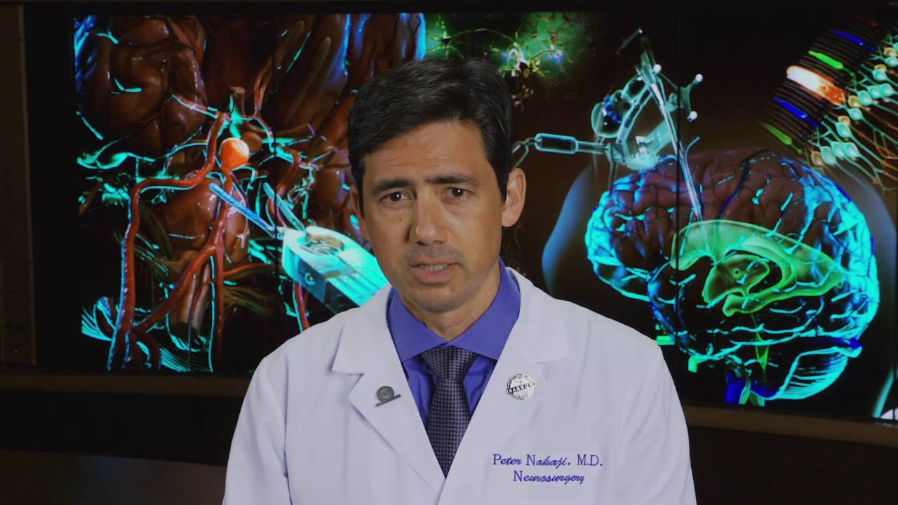 Barrow Neurosurgeon Dr. Peter Nakaji, MD, Explains, What is an Aneurysm ...