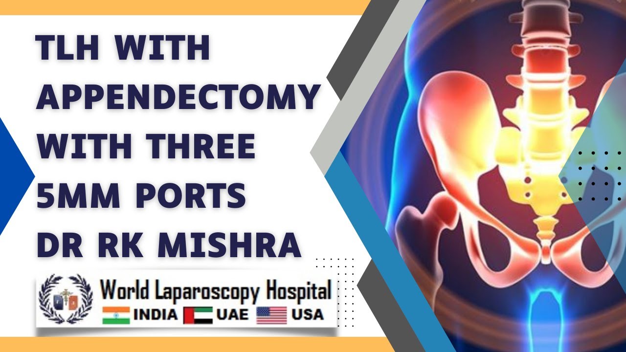 TLH and Appendectomy with Three 5 mm Ports: Approach to Gynecological ...