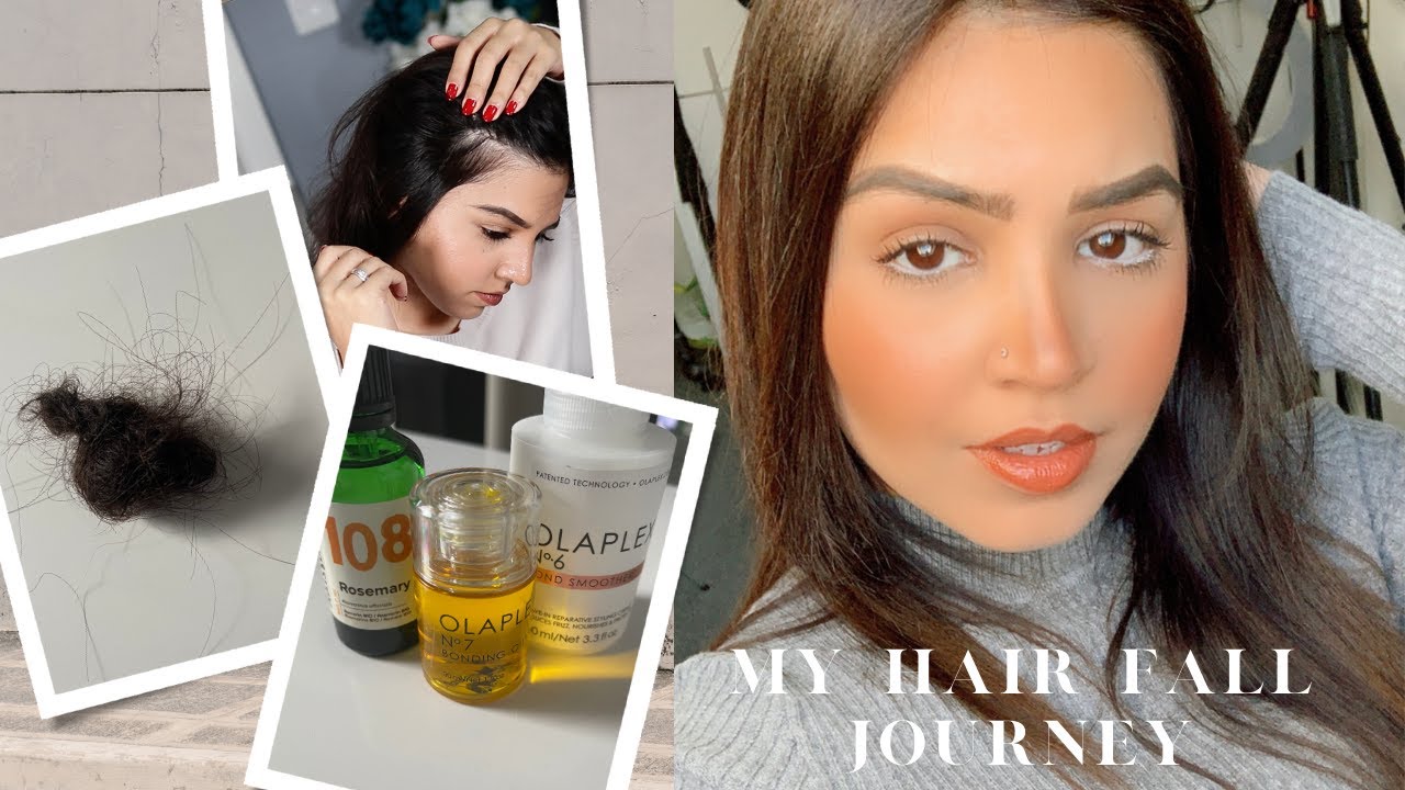 My HAIR LOSS journey! How I coped with EXTREME HAIR LOSS - YouTube