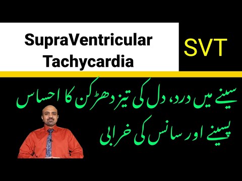 What Is SupraVentricular Tachycardia? || Some Basic Facts About SVT ...