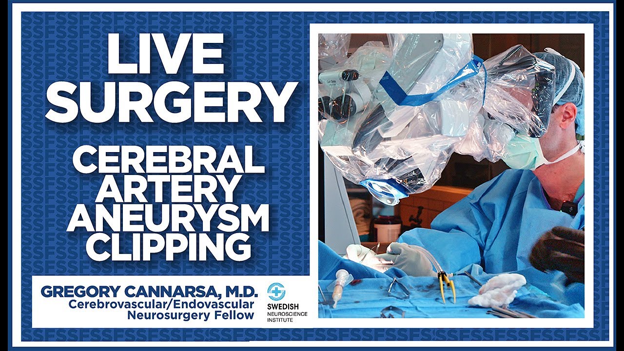 Live Surgery: Watch A Cerebral Arterial Aneurysm Clipping By Gregory ...