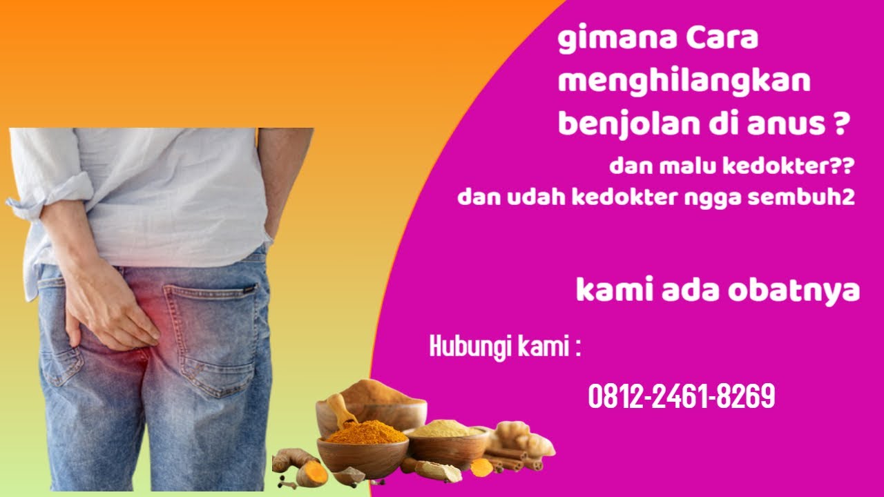 cara menghilangkan benjolan ambeien dan wasir secara alami - YouTube