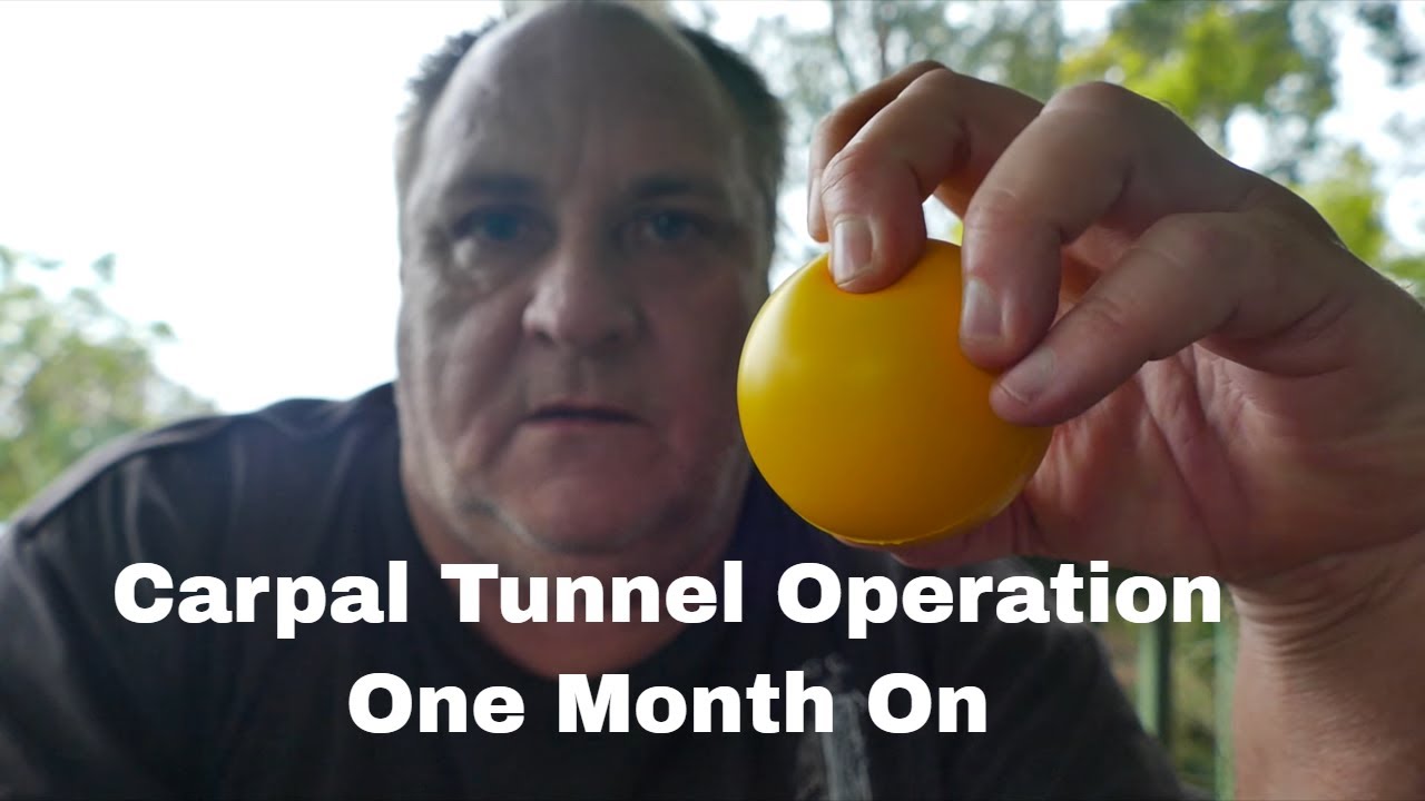 Carpal Tunnel Operation One Month On - YouTube