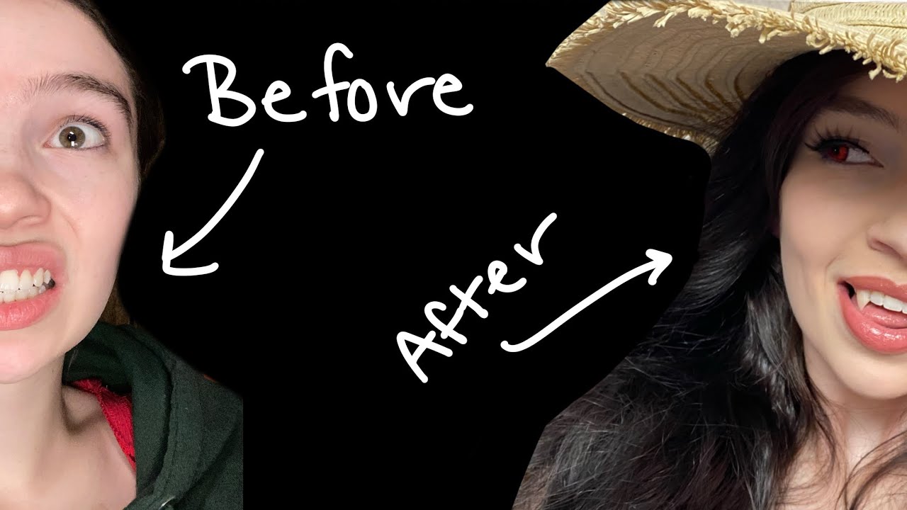 I Got Custom Fangs! - YouTube