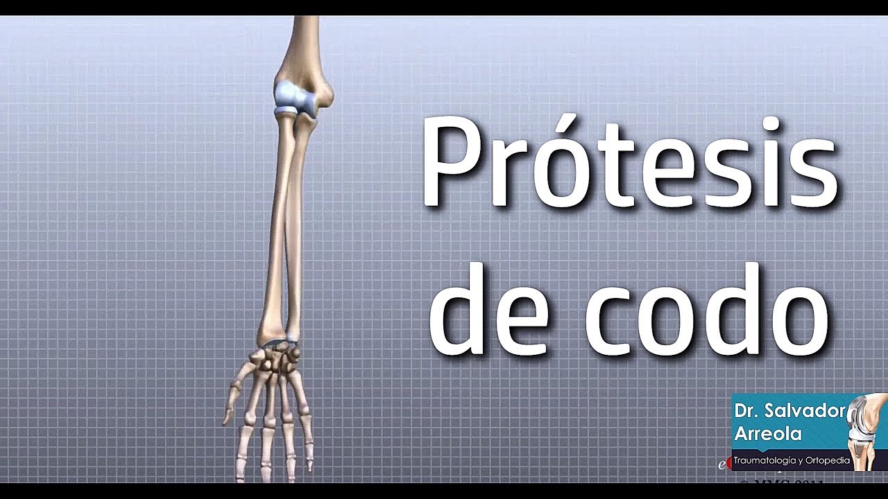 Prótesis de codo - YouTube