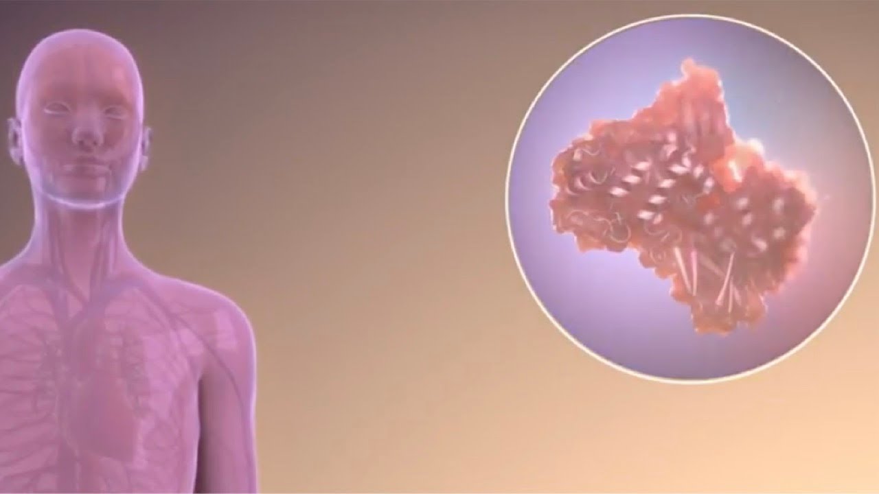An Inside Look at Fabry Disease - YouTube