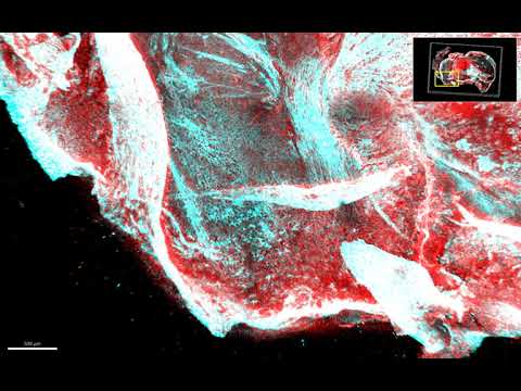 Decoding the Mouse Brain: A Coronal Section Atlas Walkthrough - Answer ...