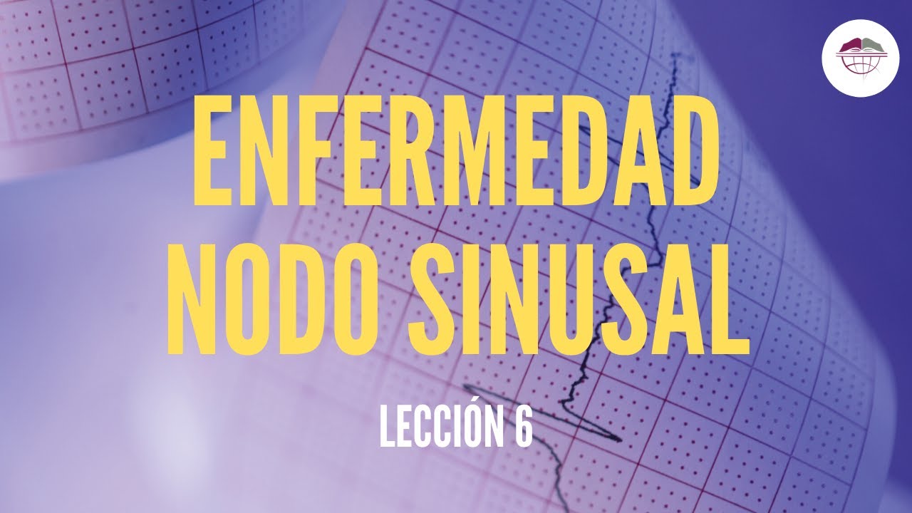 6. ENFERMEDAD NODO SINUSAL (ELECTROCARDIOGRAFÍA) - YouTube