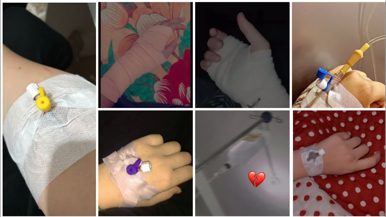 🤕😭 𝐅𝐚𝐤𝐞 𝐀𝐜𝐜𝐢𝐝𝐞𝐧𝐭 𝐝𝐩 𝐢𝐦𝐚𝐠𝐞𝐬 𝐟𝐨𝐫 𝐛𝐨𝐭𝐡 𝐠𝐢𝐫𝐥𝐬 𝐚𝐧𝐝 𝐛𝐨𝐲𝐬 || 😔🤫 𝐅𝐚𝐤𝐞 𝐡𝐚𝐧𝐝 ...