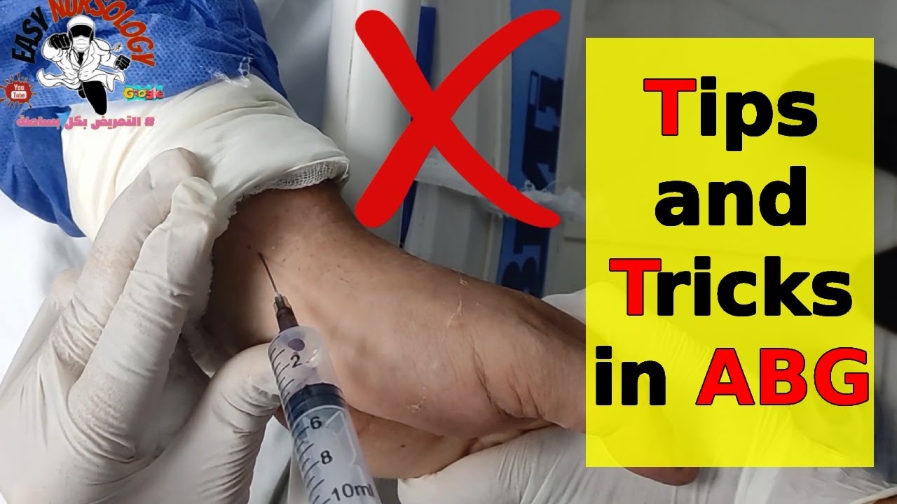 نصائح مهمة عند سحب تحليل غازات الدم (عملي) - ABG Tips And Tricks - YouTube