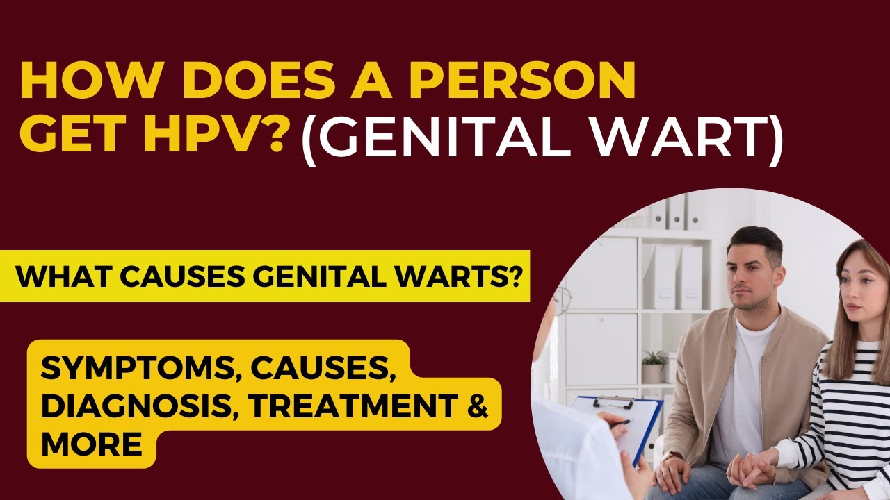 What Are HPV genital warts? Symptoms, Causes, Diagnosis, Treatment, and ...