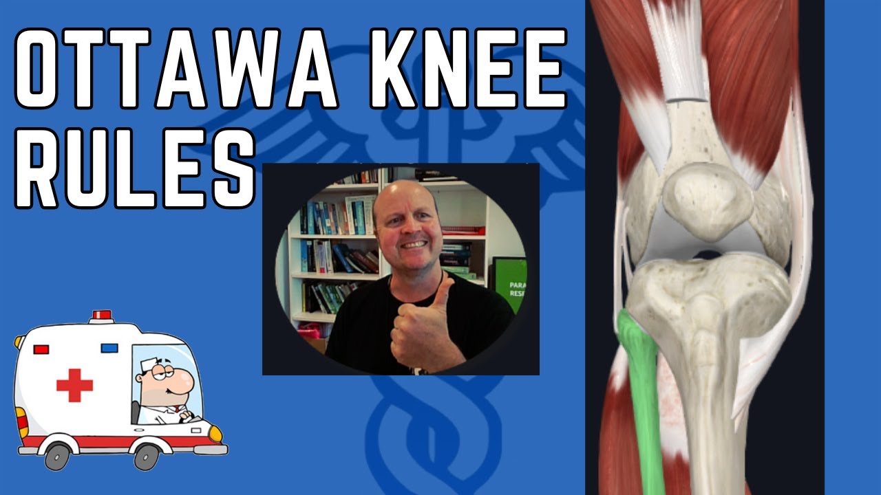 Ottawa knee rules explained - Knee Xray guidelines - YouTube