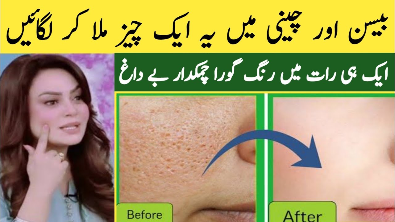 Besan Face pack for glowing skin | Homemade Face Wash | Face pack ...