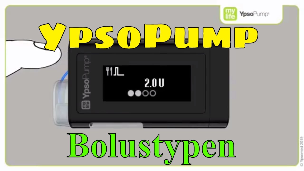 YpsoPump Verschiedene Bolustypen Insulinpumpe mylife Diabetescare 07 ...