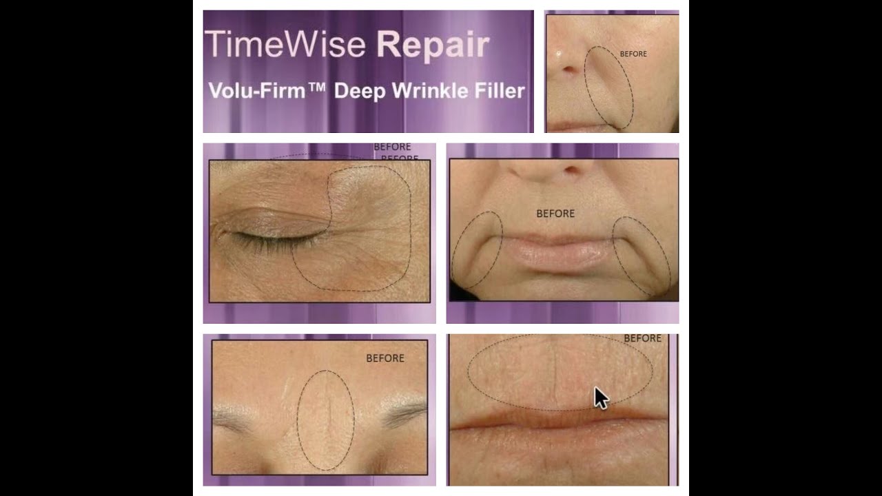 Timewise Repair Wrinkle Filler, Mary Kay,Bye-bye wrinkles - YouTube