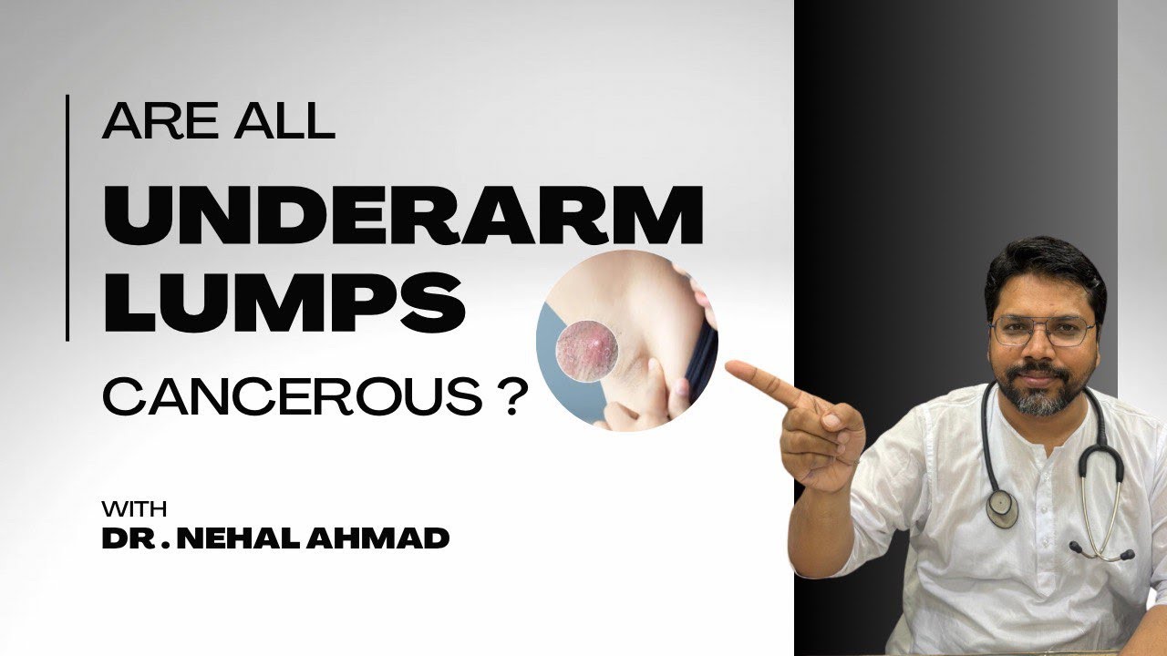 Are all underarm lumps cancerous? Explained by @drnehalsurgeon |#doctor ...