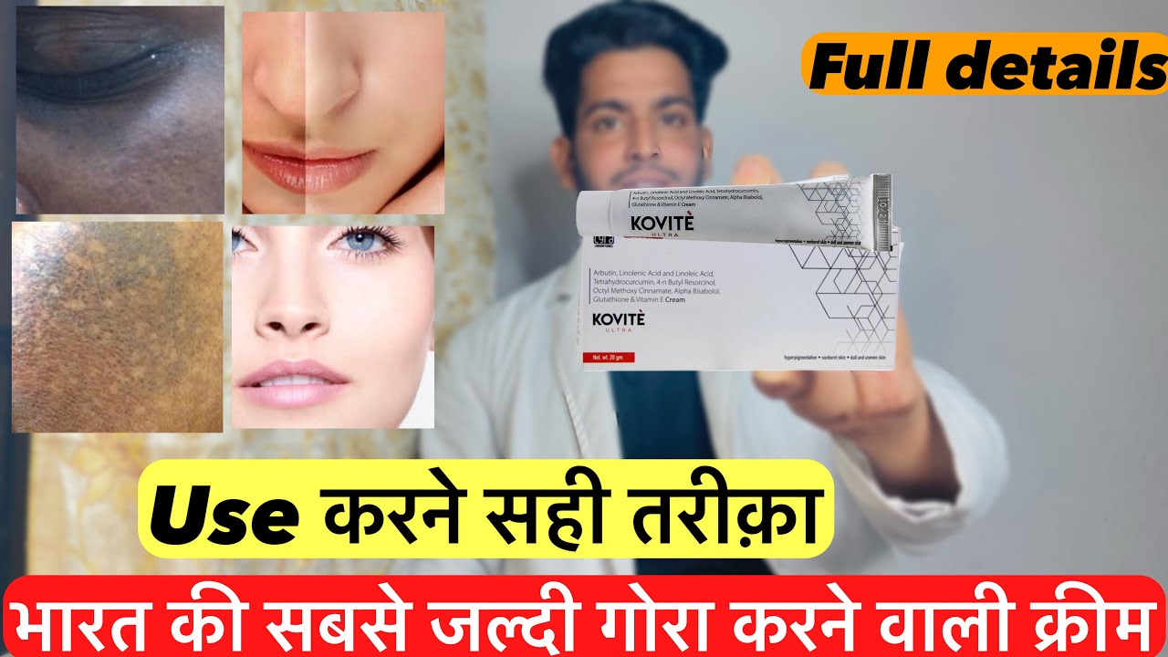 Kovite ultra cream | Kovite ultra cream review | Kovite ultra cream ...