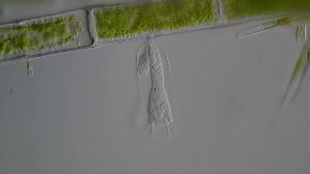 コスルニアの一種 Cothurnia sp.その2 - YouTube