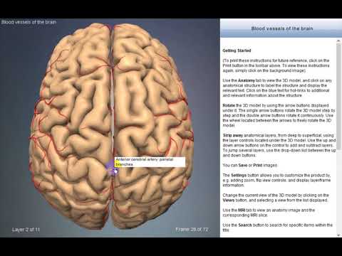 Anterior cerebral artery: parietal branches | Arteries of head and neck ...