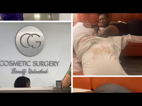 MY BBL JOURNEY: Round 2 | CG Cosmetics | Is Your 2nd Round Worse ...