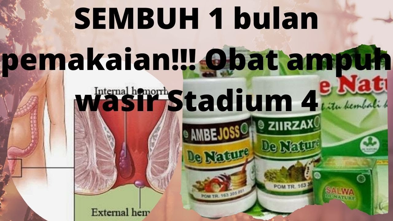 SEMBUH 1 bulan pemakaian!!! Obat ampuh wasir Stadium 4 - YouTube
