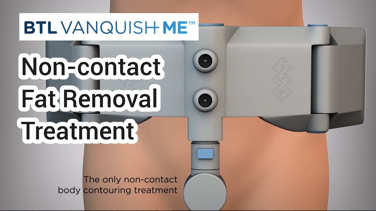 BTL Vanquish Fat Removal Singapore - YouTube