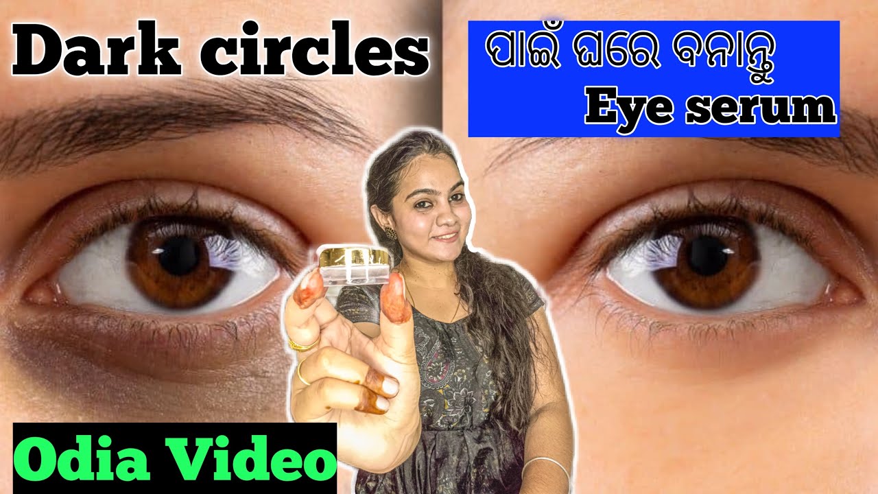 Dark circles ପାଈଁ Eye serum👍 | Odia Video | Bhubaneswar | Odisha ...