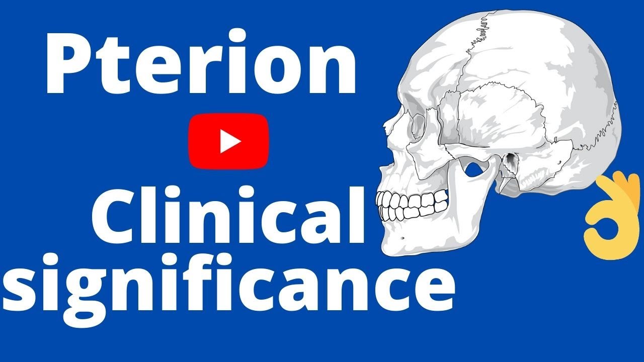 Pterion | pterion and it's importance | middle meningeal artery ...