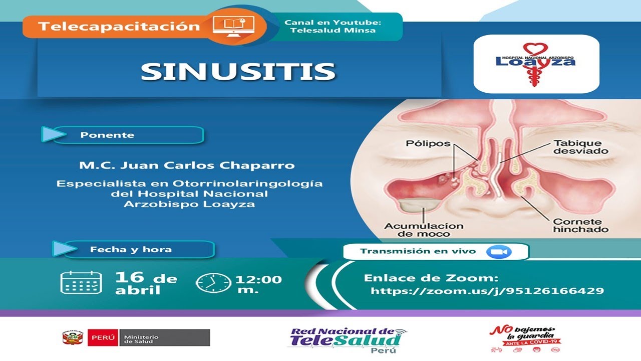 SINUSITIS - YouTube