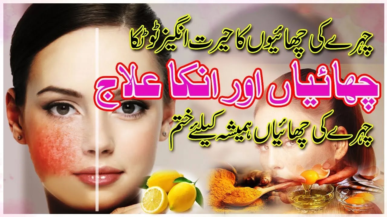 How to Get Rid of Freckles Fast Naturally | Freckles Ka Assan Ilaj ...