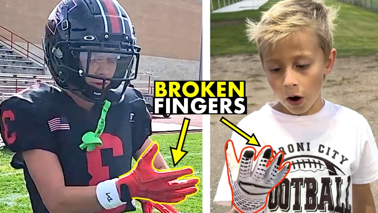 BROKEN FINGERS AT FOOTBALL GAMES! 🏈 - YouTube