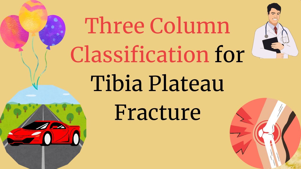 Three column classification for tibia plateau fracture #trauma # ...