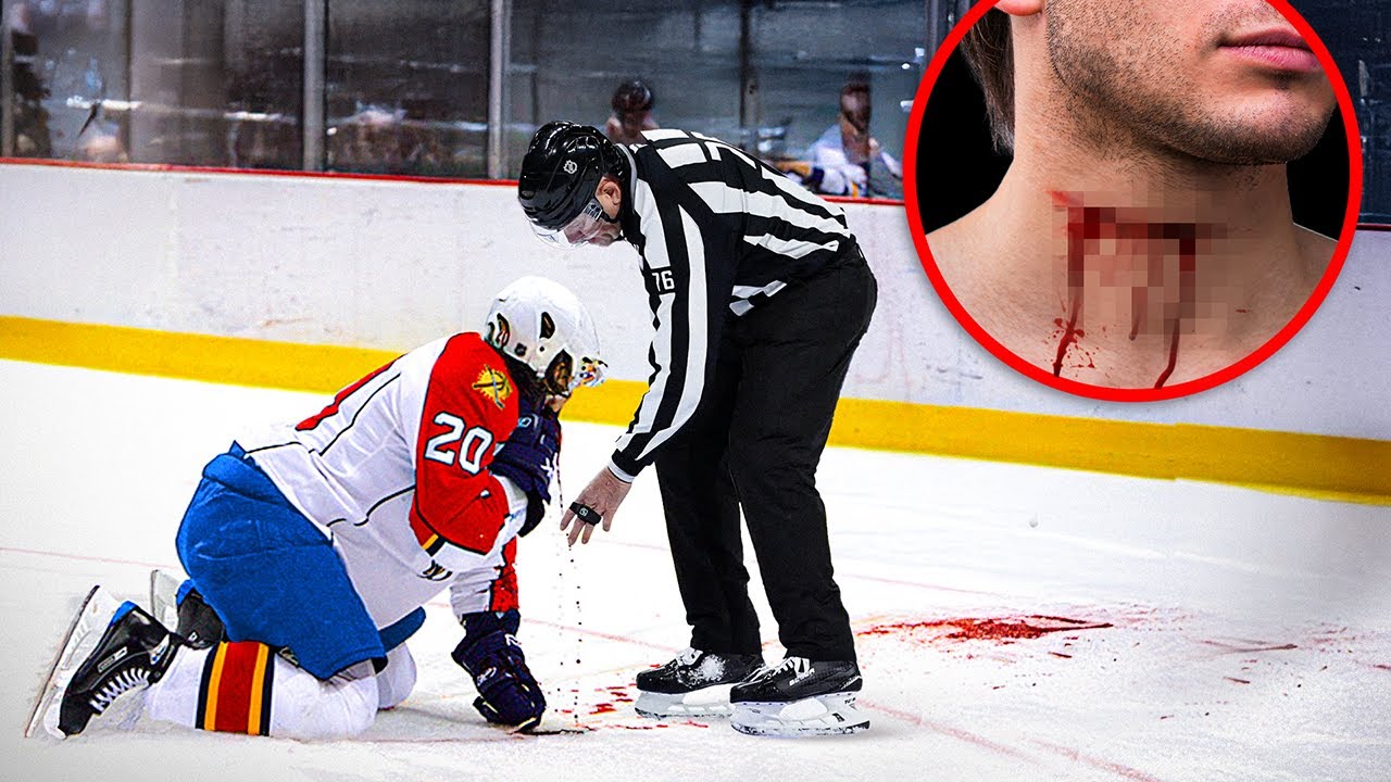 NHL Most EXTREME Injuries EVER - YouTube