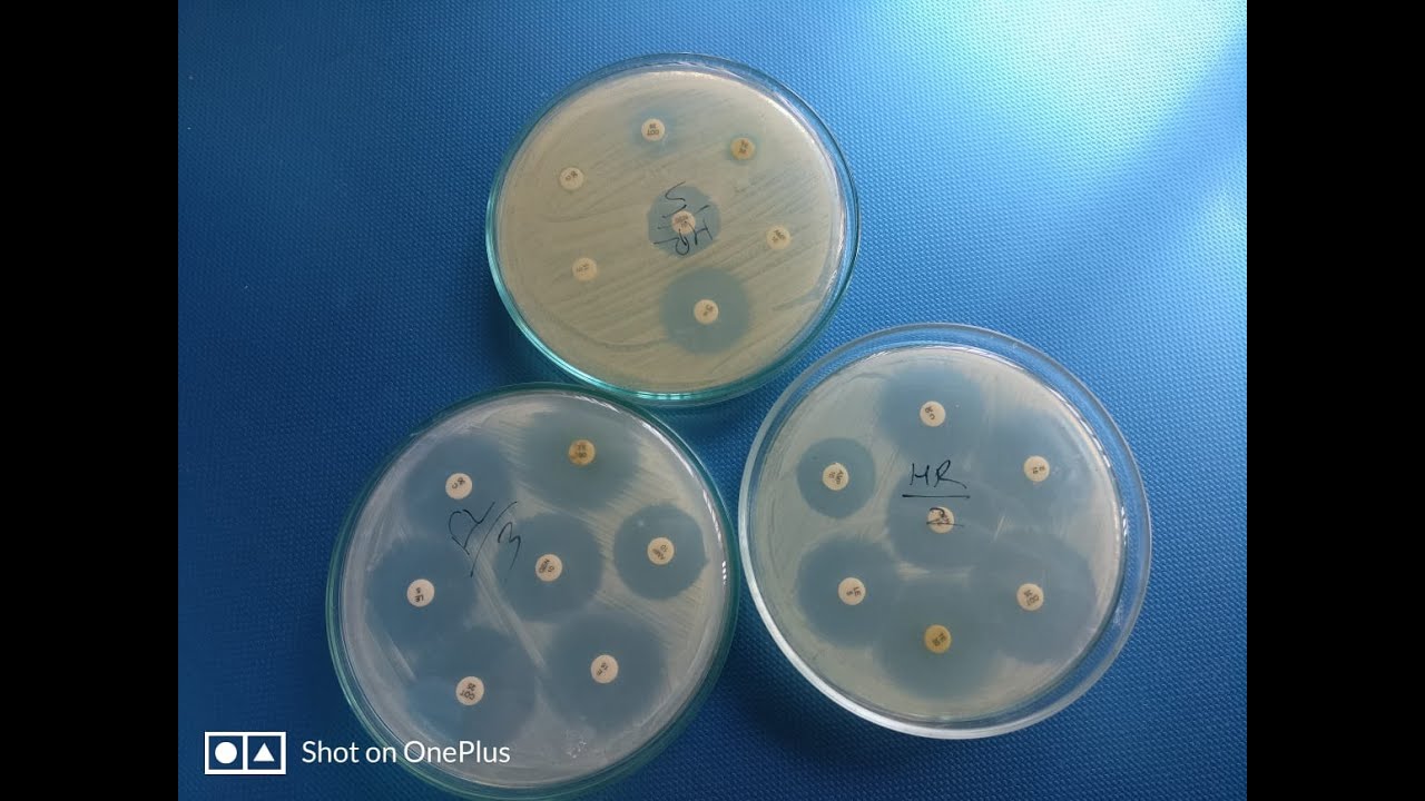 Antibiotic sensitivity test of Staphylococcus species - YouTube