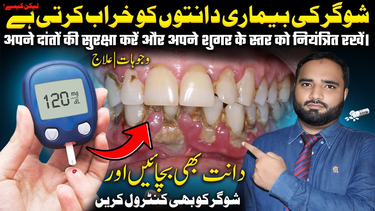 3 Simple Trick to REDUCE Tooth Decay Fast in DIABETES - YouTube