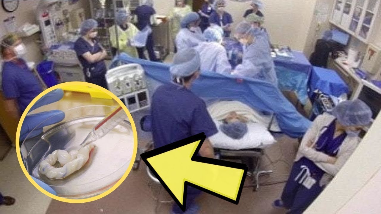 Doctor Delivers Healthy Baby, Then Sees The Umbilical Cord And Realizes ...