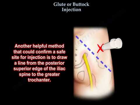 Glute injection, buttock injection