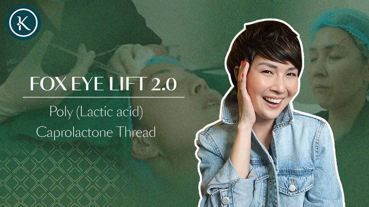 FOX EYE THREAD LIFT 2.0 | Aptos Novel Lift - YouTube