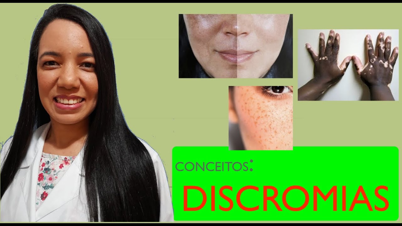 DISCROMIAS - CONCEITOS E EXEMPLOS - YouTube