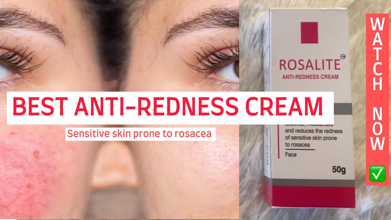 ROSALITE ANTI-REDNESS CREAM|skin allergy |sensitive skin prone to ...