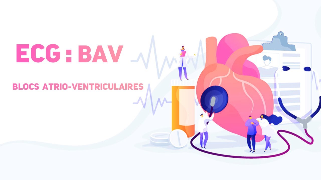 ECG : Blocs Atrio-ventriculaires (avec des exemples) - YouTube