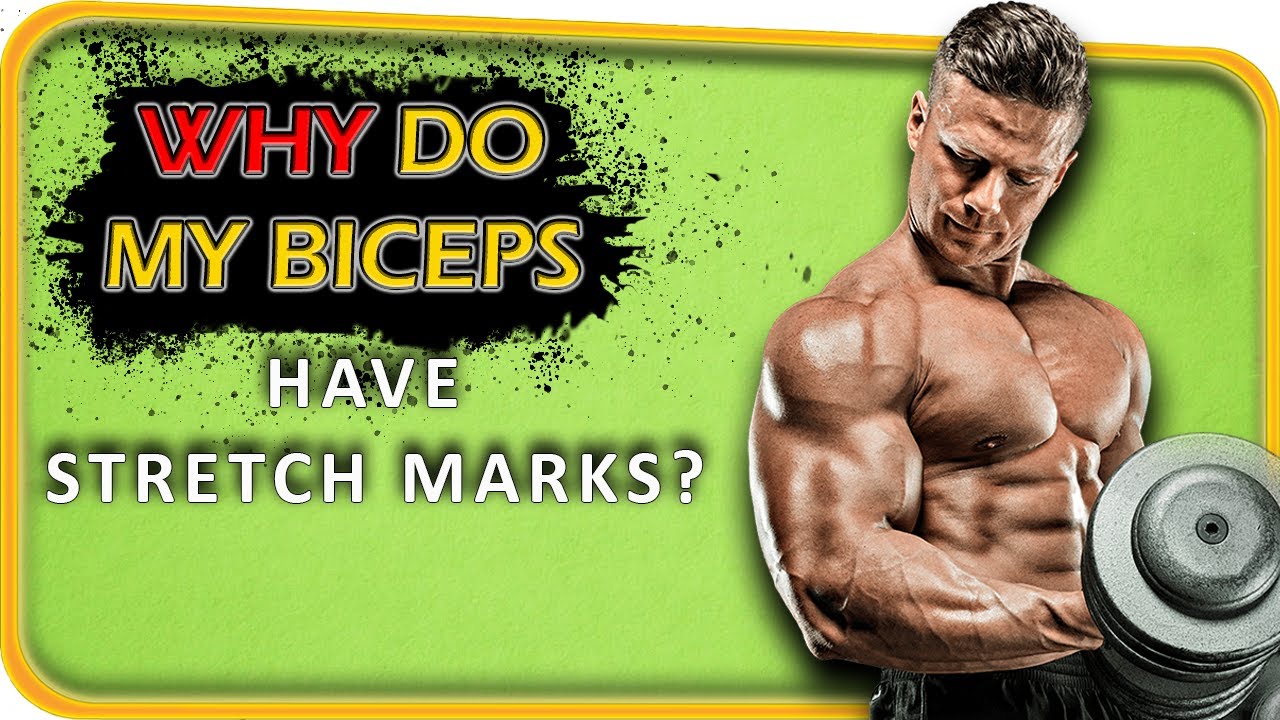Bicep Stretch Marks