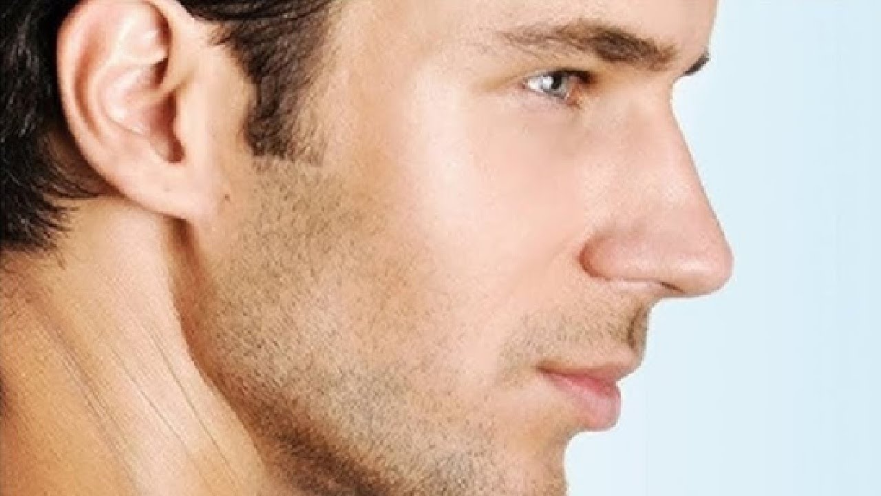 HOW TO GET RID OF CHUBBY CHEEKS YOU MUST TRY THIS - YouTube