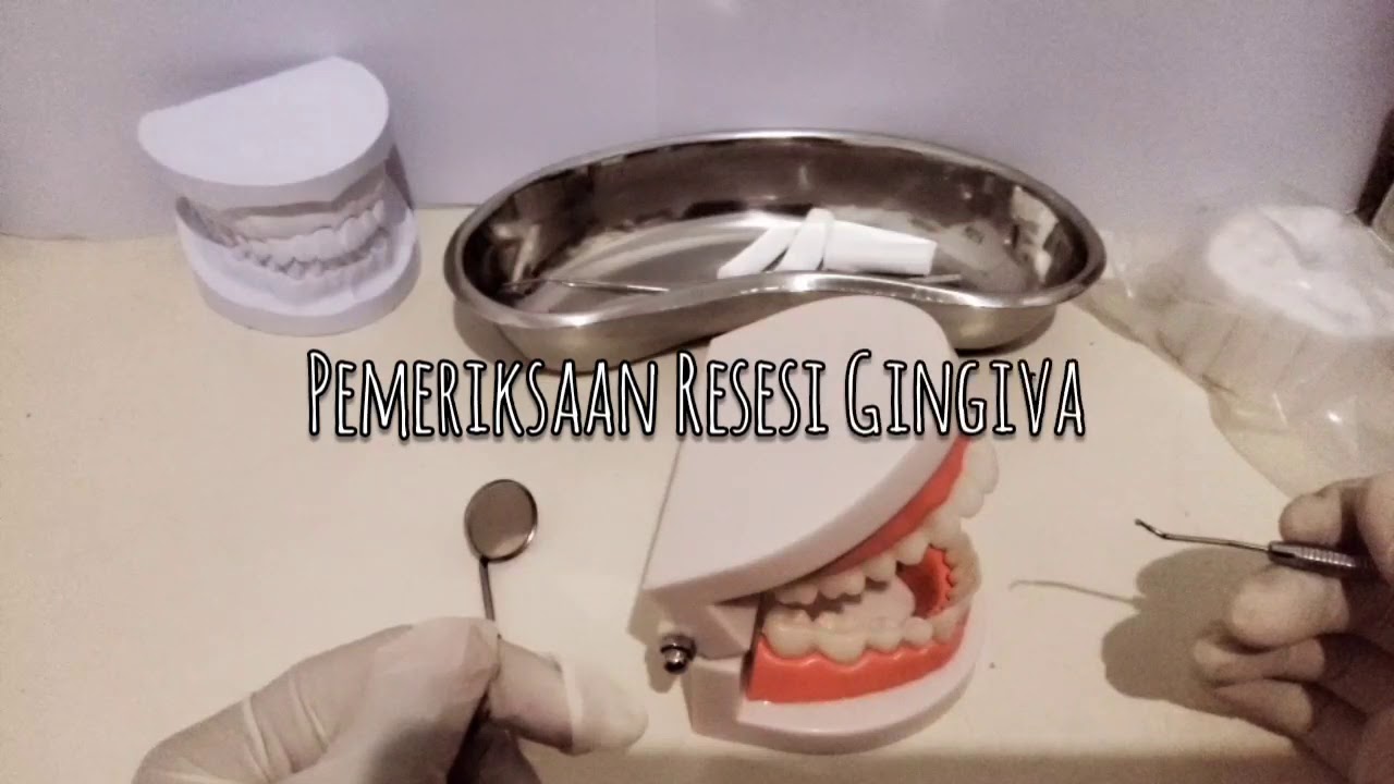 Pemeriksaan Resesi Gingiva - YouTube