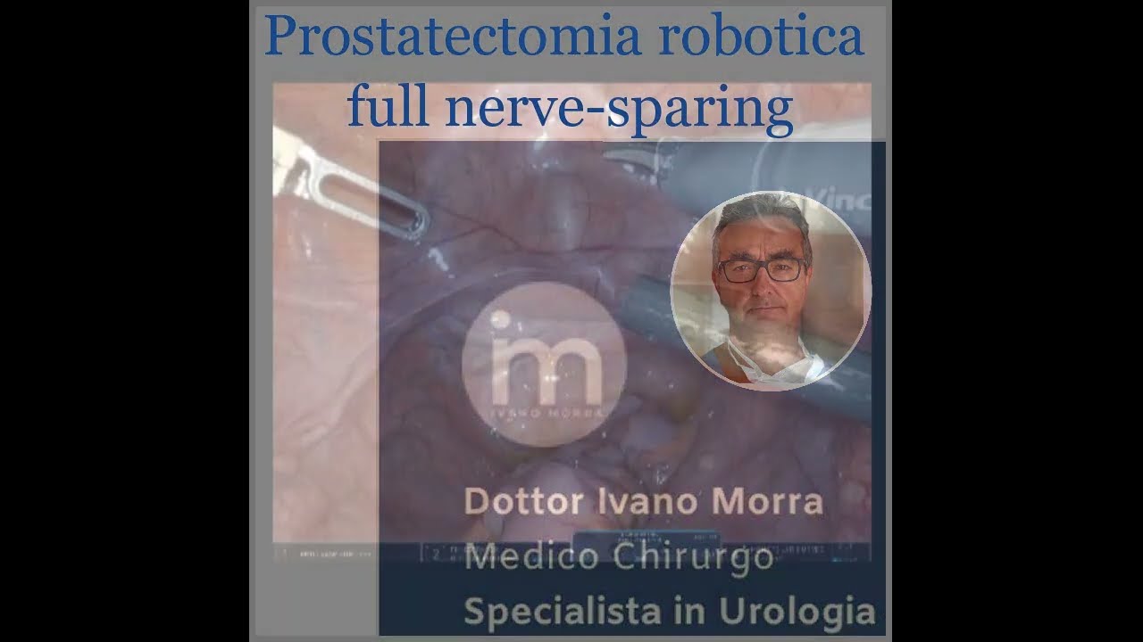 RARP full nerve sparing & bladder sparing - YouTube