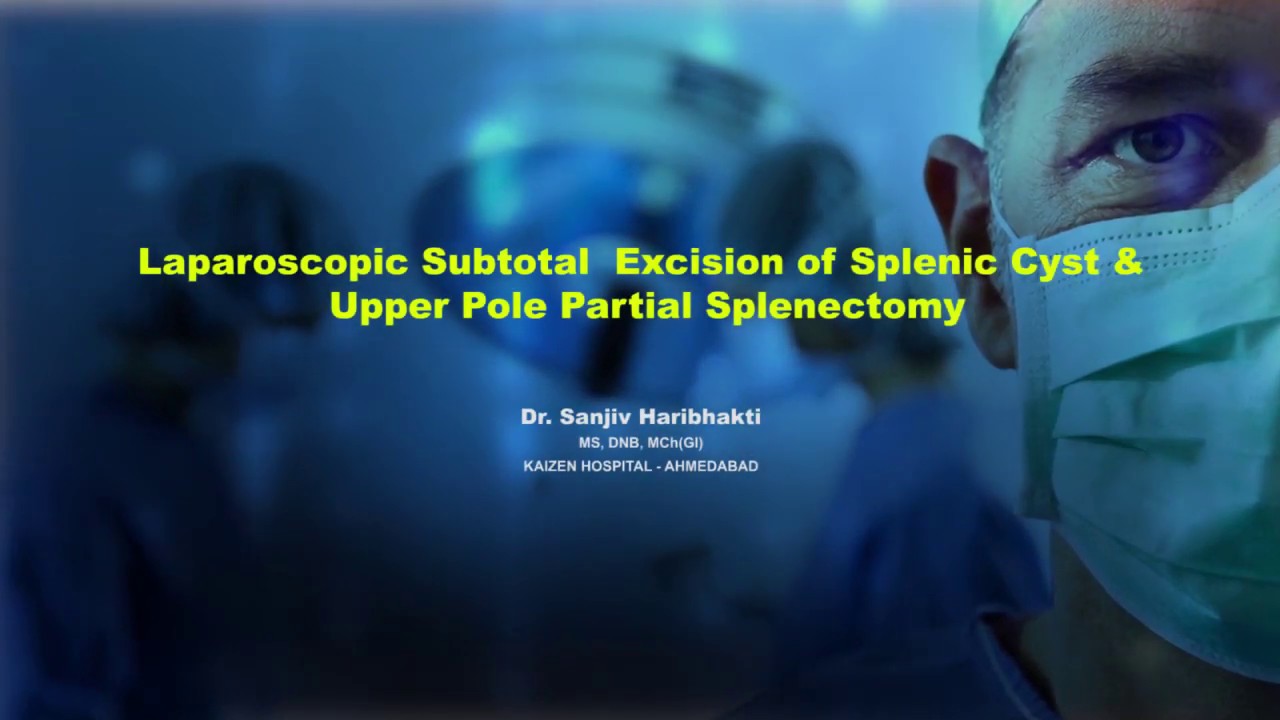 Laparoscopic Subtotal Excision of Splenic Cyst & Upper Pole Partial ...